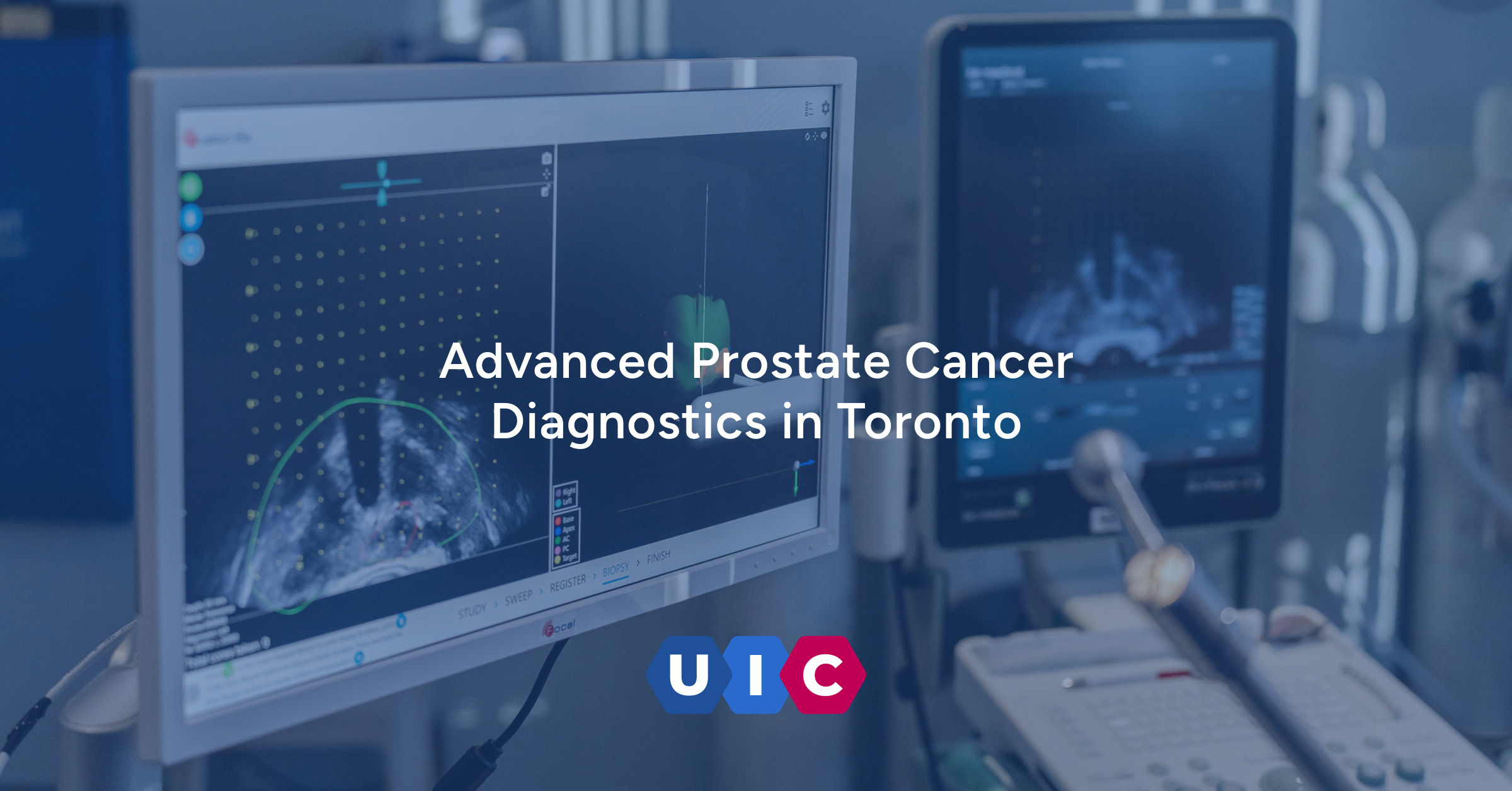 Prostate Cancer Diagnostics - Urology Innovations Canada